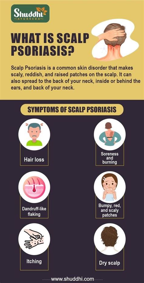 Scalp Psoriasis Causes Artofit