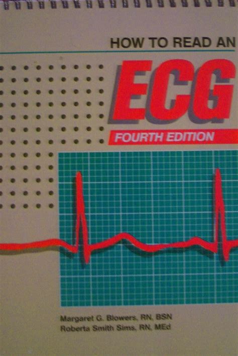How To Read An Electrocardiogram Buy Online At Best Price In Ksa