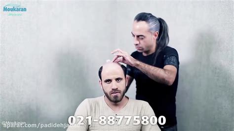 ترمیم مو و کاشت موی طبیعی بدون جراحی