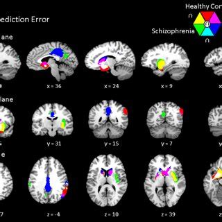 Negative Prediction Error In Three Groups Negative Correlates Of