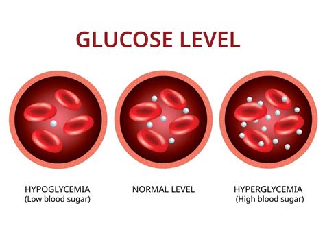 Hyperglycemia Vs Hypoglycemia Why Both Are Bad