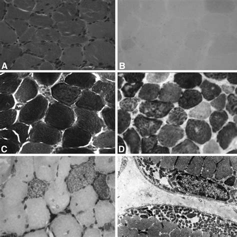 Replicative Segregation And The Threshold Effect Mitochondria And The