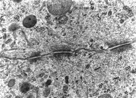 120 Fotos Bilder Und Lizenzfreie Bilder Zu Desmosom Fotos Istock