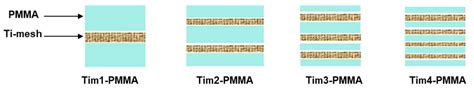 Enhancing Polymethyl Methacrylate Prostheses For Cranioplasty With Ti Mesh Inlays