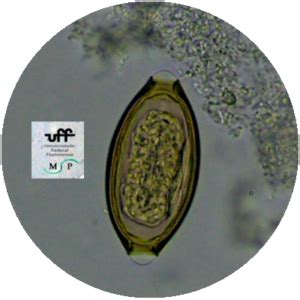 Atlas Virtual De Parasitologia