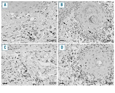 Immunohistochemical Analysis On Formalin Fixed And Paraffin Embedded