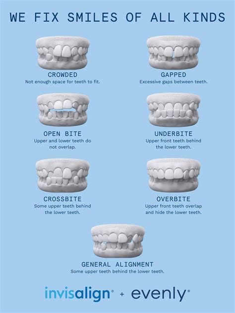 Invisalign East Norriton Pa Straighten Teeth Invisible Aligners