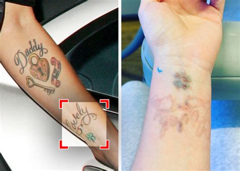 Tattoo Regret People Are Sharing Their Tattoo Regrets