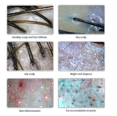 3 Days Korean Hair And Scalp Course Spa Care Amoaesthetics Academy