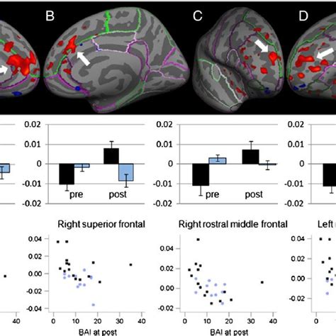 Functional Connectivity Between The Seed Region In The Right Amygdala