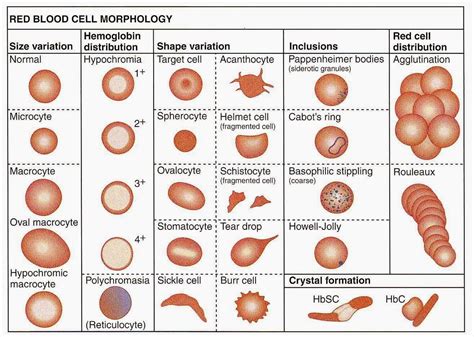 Medical Laboratory And Biomedical Science Red Blood Cell Morphology