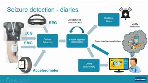 Seizure Detection With Wearable Devices And Ai Christos
