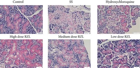 Rzl Inhibits Inflammatory Reactions In The Submandibular Gland Of Ss