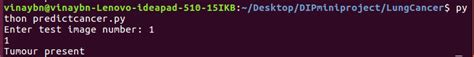 Github Vinaybn8997lungcancerdetectionusingpython Lung Cancer Detection From Images
