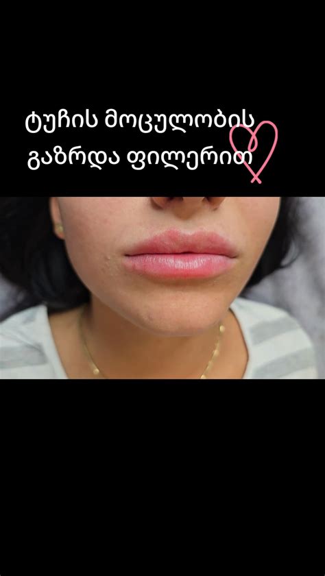 Valbella ესთეტიკის ცენტრი Gori