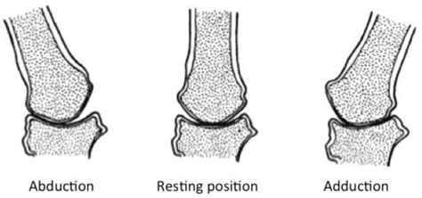 Noncongruence Of The Tmc Joint By Napier Et Al 14 Download