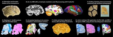 Nextbrain