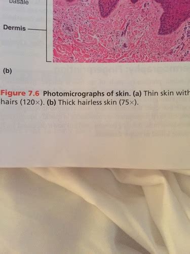 Anatomy Lab Ch Integumentary Flashcards Quizlet