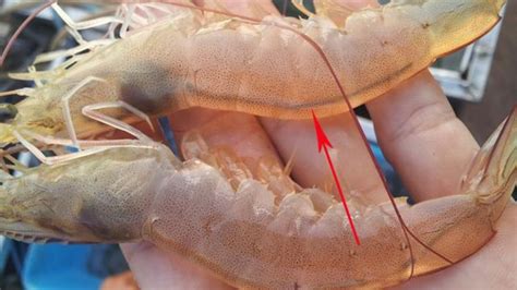 Con Tôm Có 2 Bộ Phận ăn Nhầm Dễ Rước Bệnh Cần Biết Và 3 Phần Trên Con