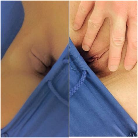 Showing Her Shaved Pussy In Scrubs Pic