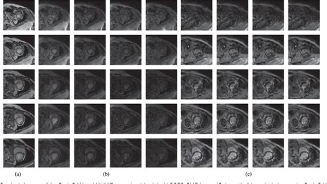table 4 from cross modality lge cmr segmentation using image to image