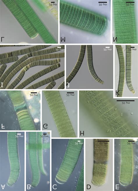 Oscillatoria Under A Microscope
