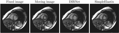 【论文笔记】基于深度学习的端到端无监督配准模型——变形图像配准网络（deformable Image Registration Network Dirnet）end To End