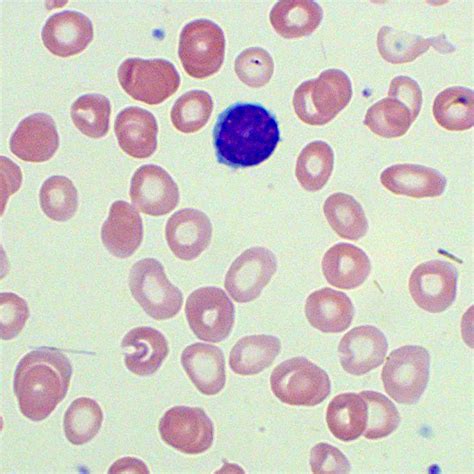 Lymphocytes Under Microscope