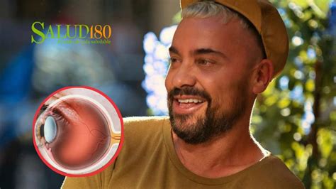 Famoso Conductor Queda Ciego Tras Cirugía Para Eliminar Bolsas De Los