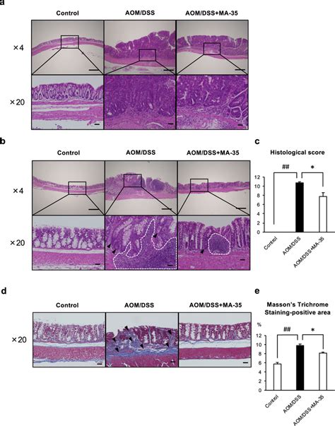 Histopathological Analysis In The Distal Colon With H E Staining Download Scientific Diagram