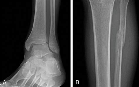 Imaging Of The Foot And Ankle Clinical Tree