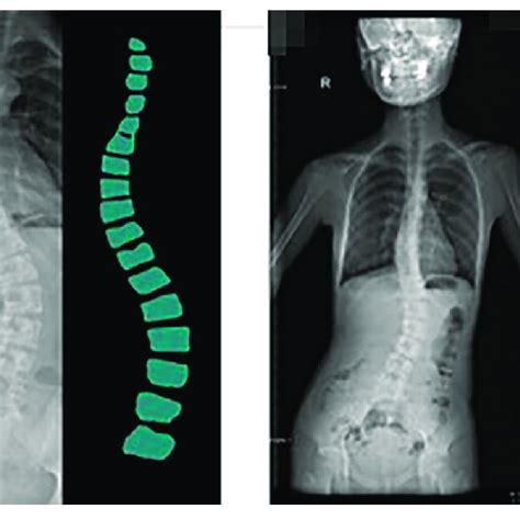 The Segmentation Prediction Results Generated By Ci Unet Download Scientific Diagram