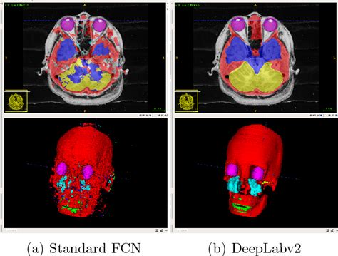 Comparison Of The Deep Learning Based Automated Segmentation Methods For The Head Sectioned