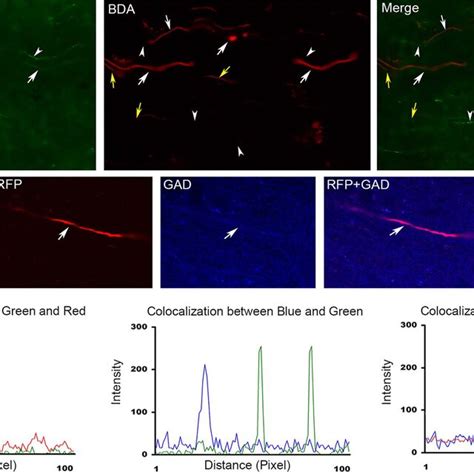 Differential Expression Of Gfp And Rfp Signals In Excitatory And