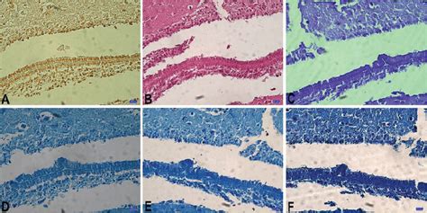 Appearance Of Choroid Plexus According To Different Staining Methods Download Scientific