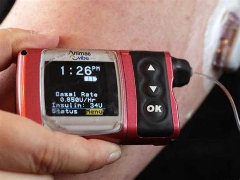 Pacemakers Defibrillators Are Medical Iot Devices Trustworthy By As
