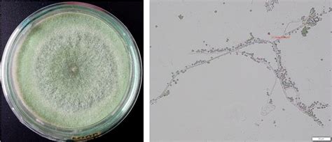 Macroscopic Characteristics Of Trichoderma Mlt2j2 At 5 D With White