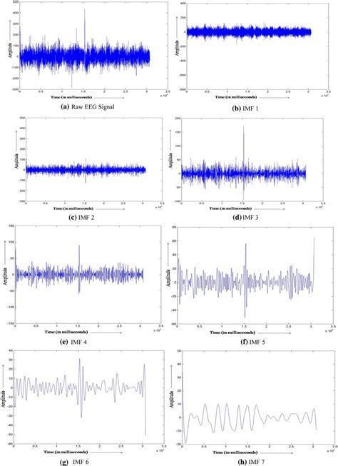 Empirical Mode Decomposition Of A 10 S Eeg Signal Of F3 Electrode Download Scientific Diagram