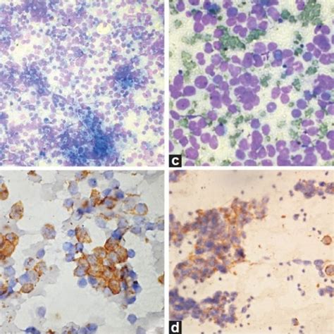 Pdf Malignant Small Round Cell Tumors