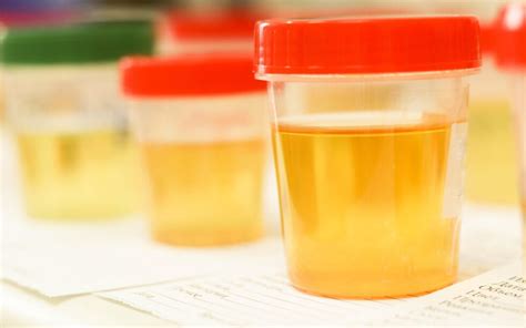 Benefits Of Dna Sequencing In Microbial Genomics