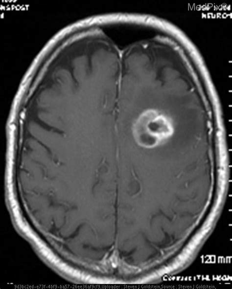 Hongyipengvqa Rad · Datasets At Hugging Face Hongyipengvqa Rad · Datasets At Hugging Face