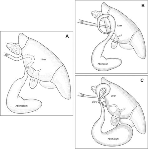 Function Of Sigmoid Flexure In Bull At Felipe Heidt Blog