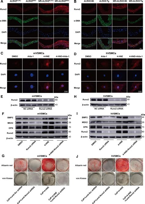 Carbonylation Of Runx2 At K176 By 4 Hydroxynonenal Accelerates Vascular