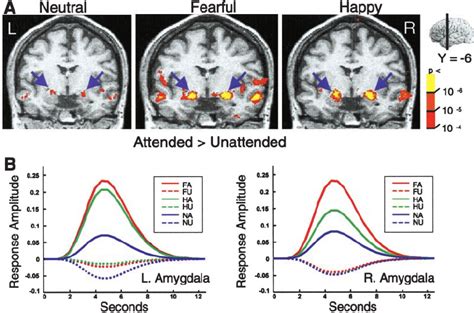 Attention And Valence Effects In The Amygdala A Arrows Point To