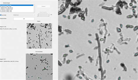 Automated Fungal Spore Count Biosensesolutions