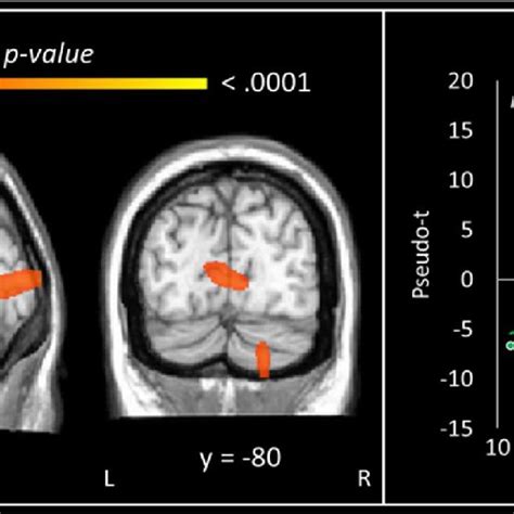 Sex Differences In The Correlation Between Theta Activity And
