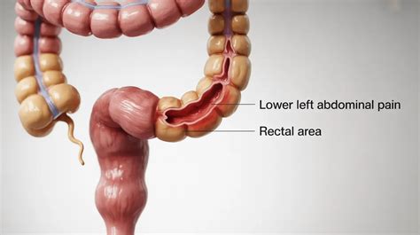 Understanding Liver Function Tests Alt Ast And Bilirubin Explained