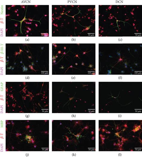 Neural Stem Cells Of All Cn Subnuclei Can Differentiate Into The Cell Download High Quality