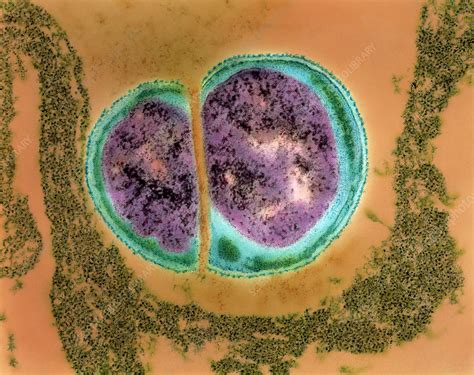 Alloiococcus Bacterium Stock Image B220 1130 Science Photo Library