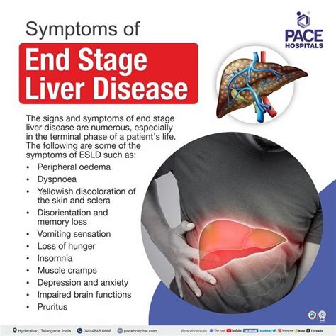 Liver Disease Symptoms Lipschitz